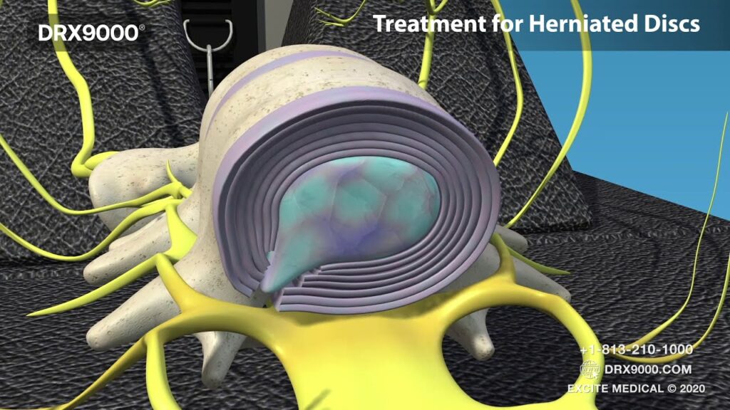 Home – True Spinal Decompression™